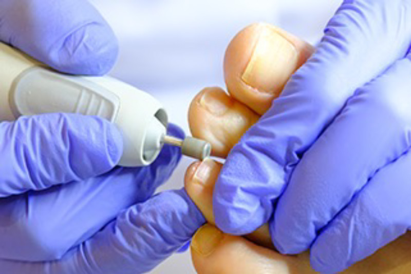 Podiatry fees | The Foot Clinic Paignton